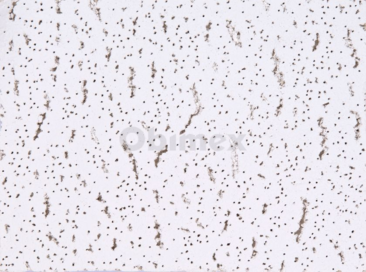 Armstrong board tatra 755 600x1200x15 (10pl/pk)*ORIGINAL* | Obimex ...